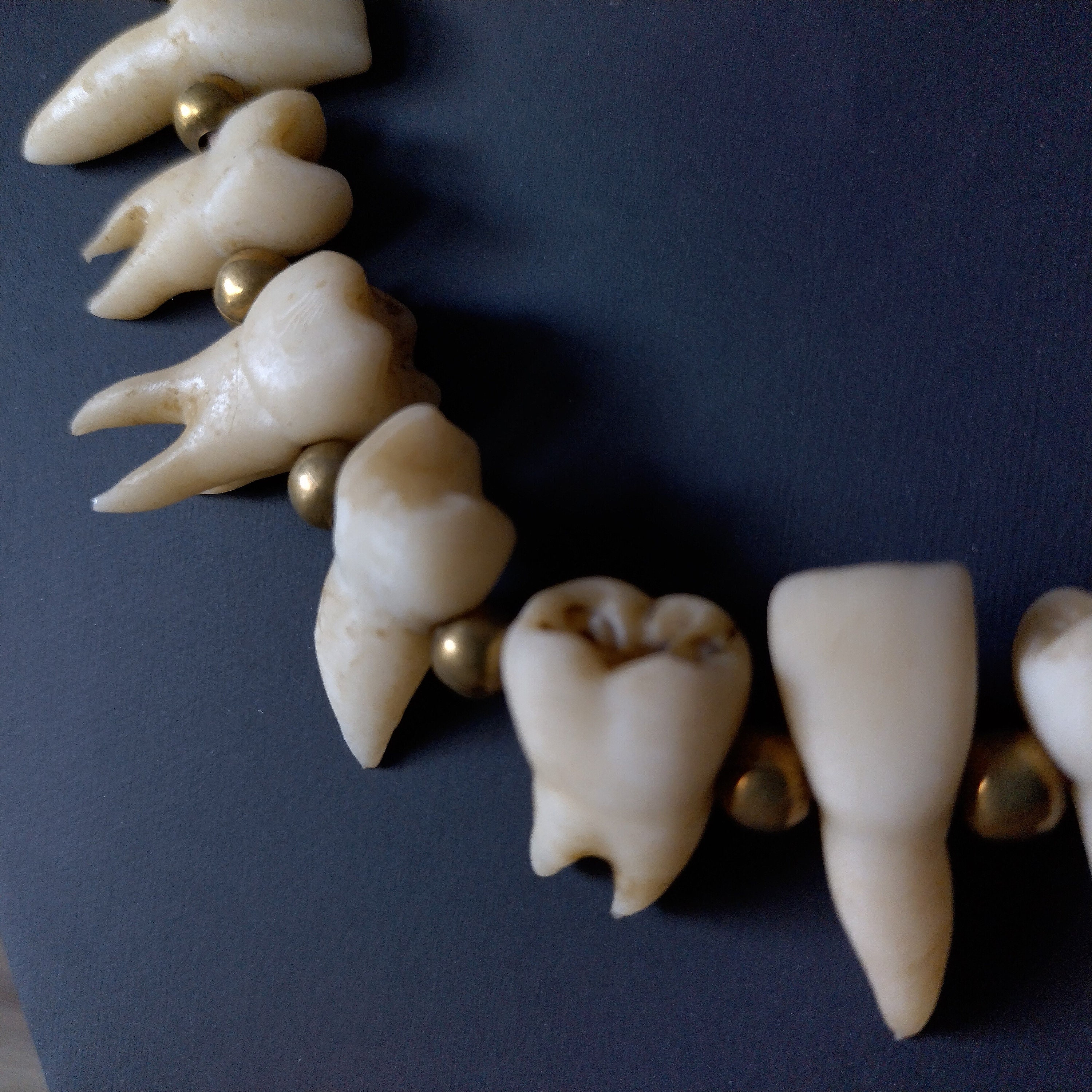 Aged Human Teeth Necklace With Brass Beads - Etsy