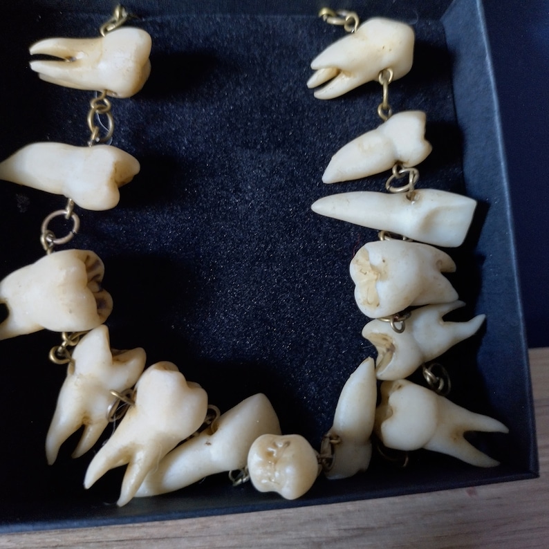 Aged Human Teeth Necklace on Bronze Chain - Etsy