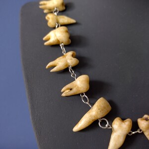 Aged Human Teeth Necklace on Silver (look) Chain - Etsy