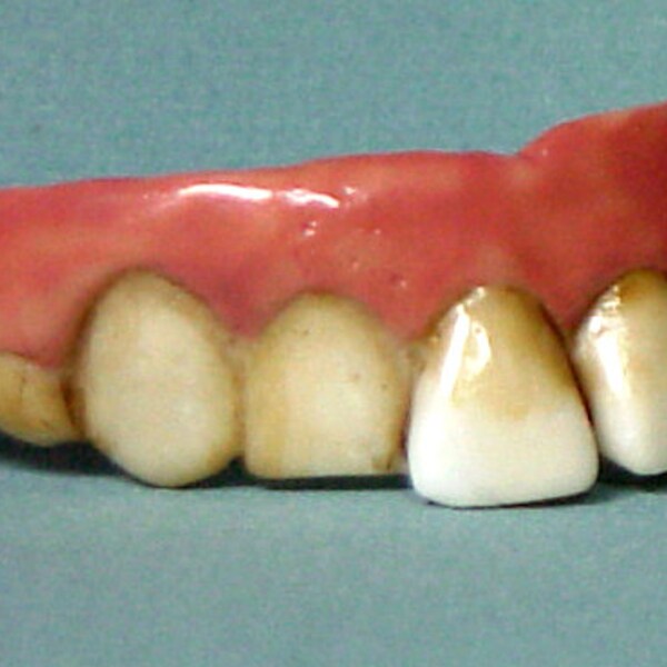 Costume Fake Teeth - Etsy