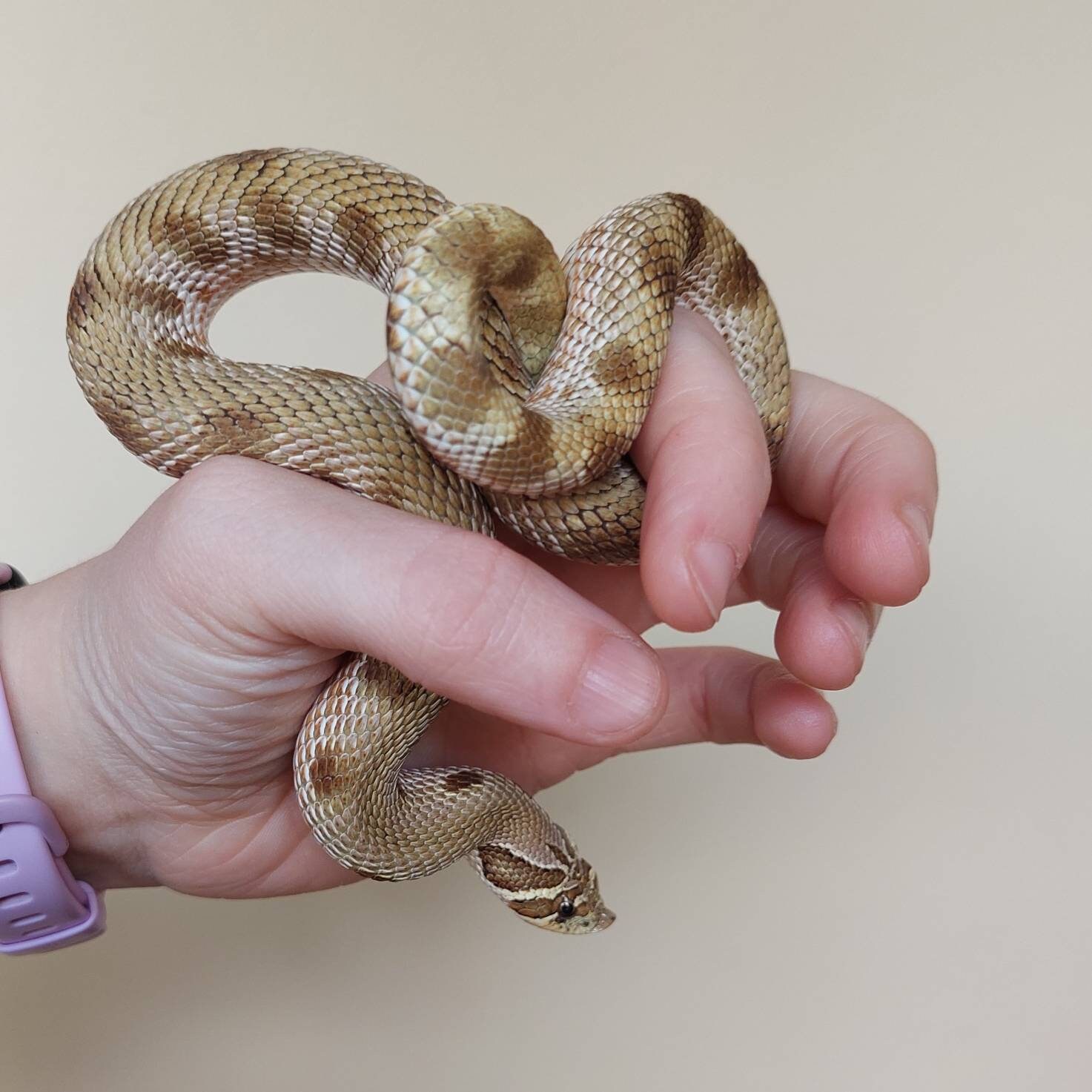 Hognose Snake Skin Shed 'anaconda' Morph C.20 Inches - Etsy