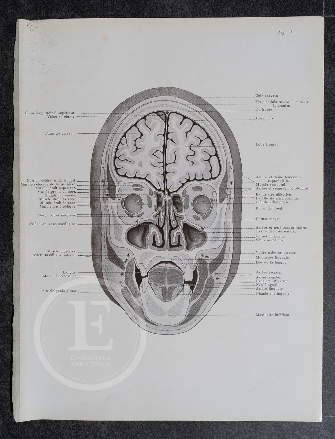Frontal Section of the Head, Orbital Cavities and Nassal Fossae - Human ...