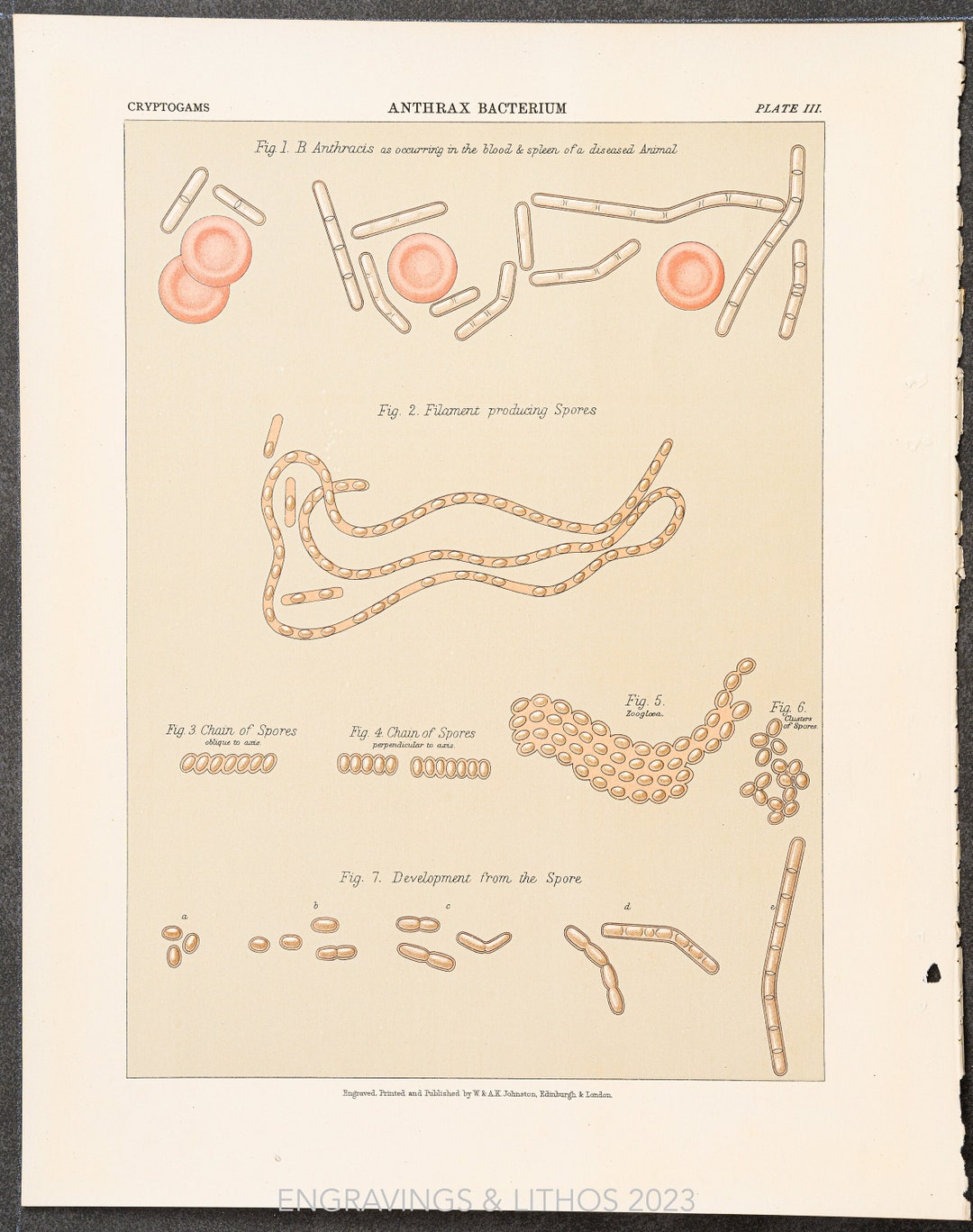 Anthrax Bacterium - Original Print Out of the Botanical Atlas by D M ...