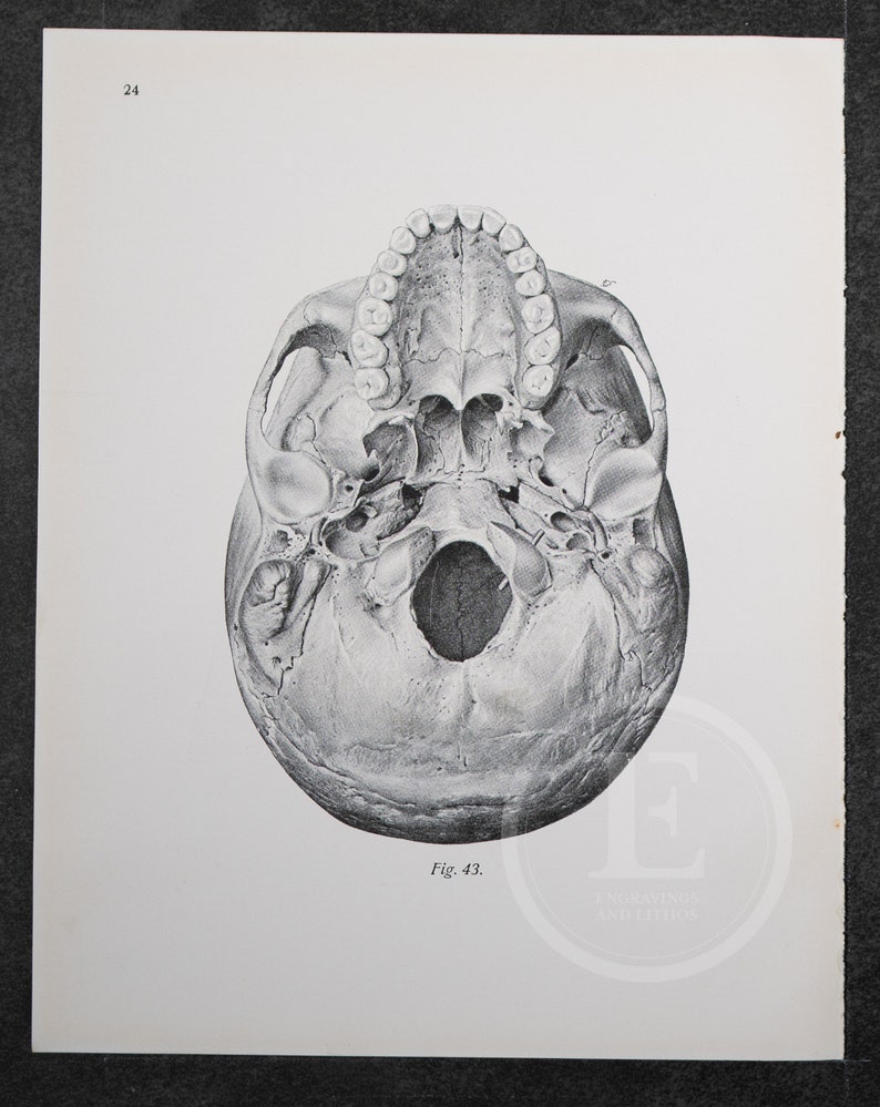 Left Side of the Skull / Outer Skull Base / Human Anatomy - Etsy