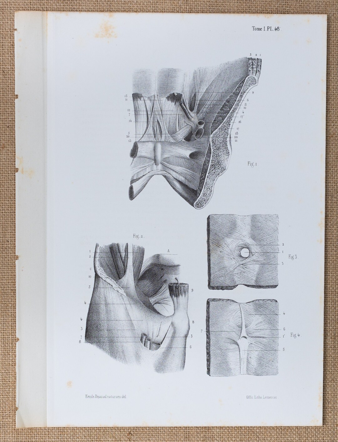 Sacrum Muscle - RARE ORIGINAL PRINT From Atlas D'anatomie Descriptive ...