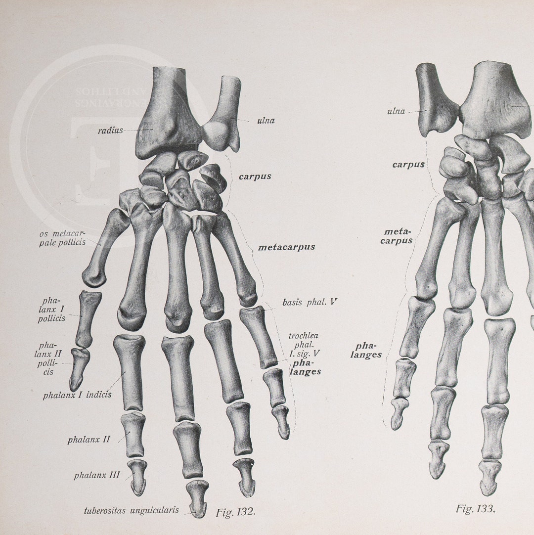 Metacarpal Bones / Hand Phalanges /human Anatomy - Descriptive Anatomy ...