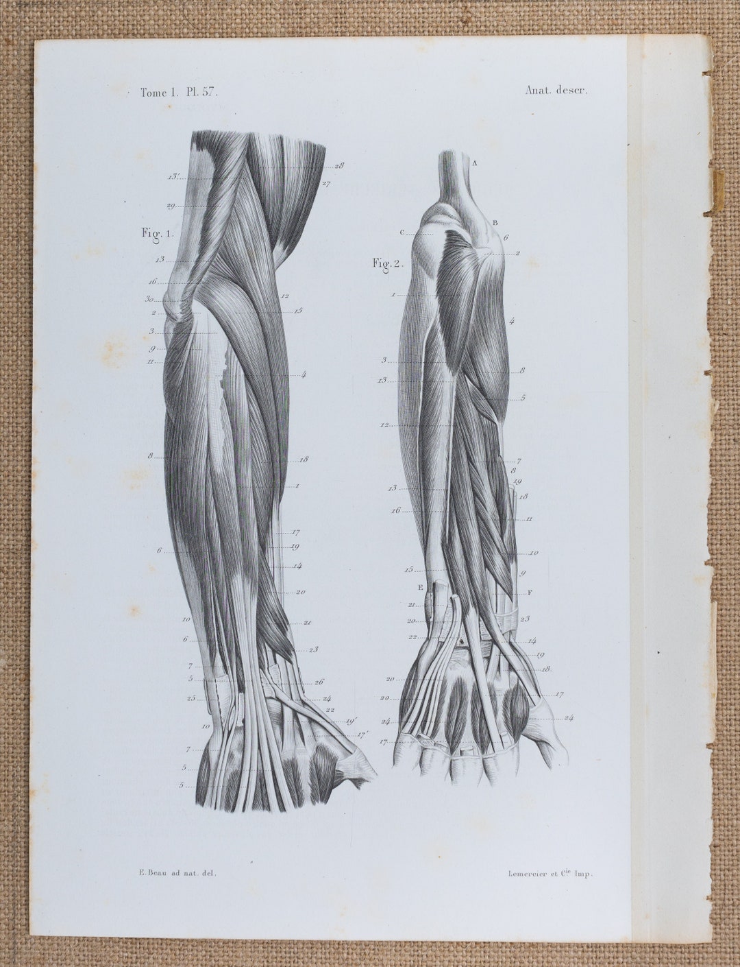 Hand Arm Muscle Anatomy - RARE ORIGINAL PRINT From Atlas D'anatomie ...