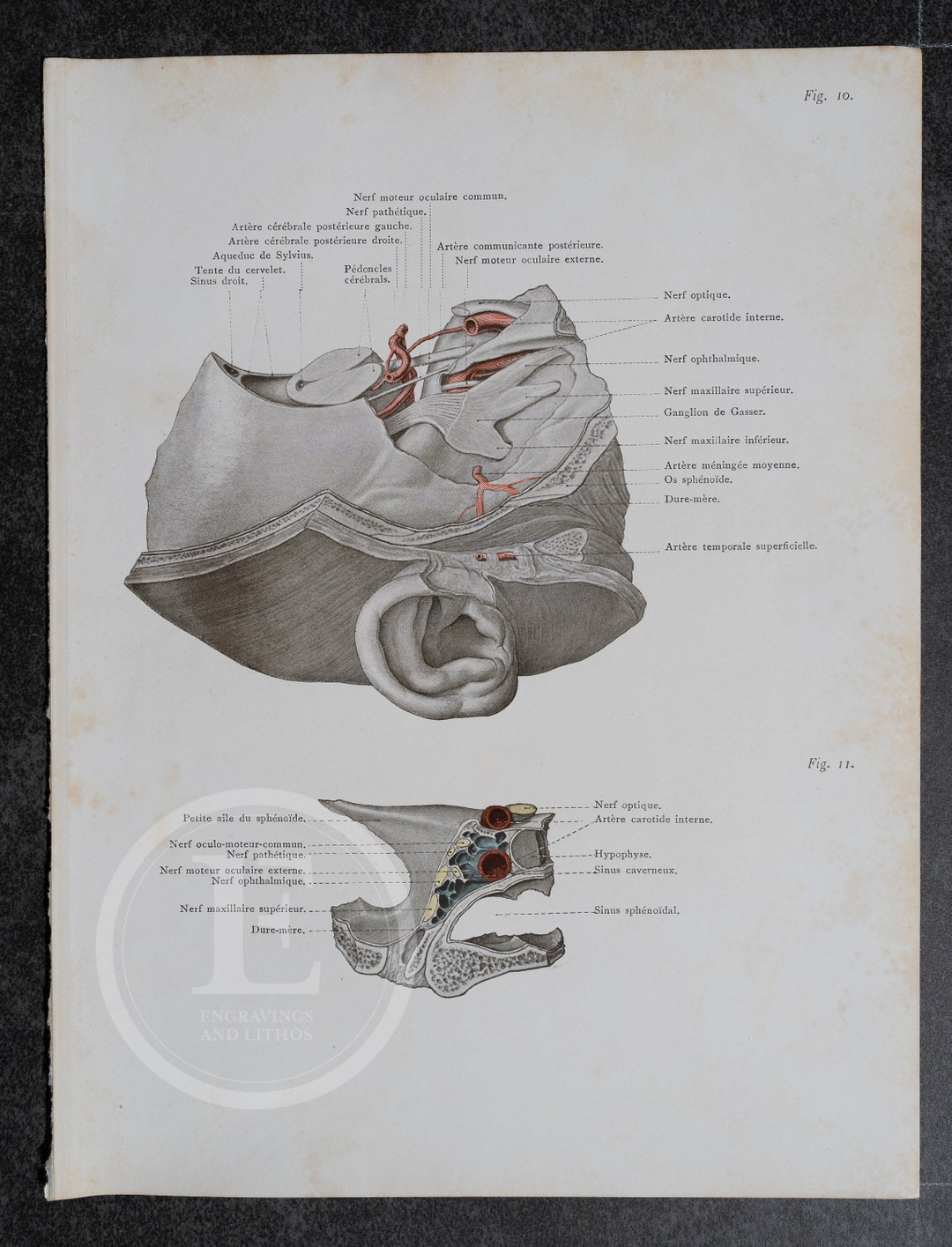 Gasserian Ganglion, in Place in the Middle Cranial Fossa - Human ...