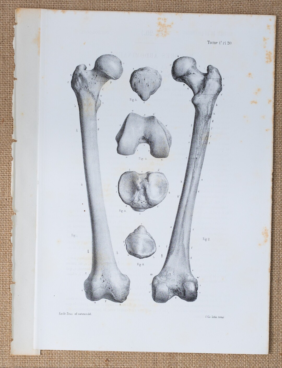 Thigh Bones - RARE ORIGINAL PRINT From Atlas D'anatomie Descriptive Du ...