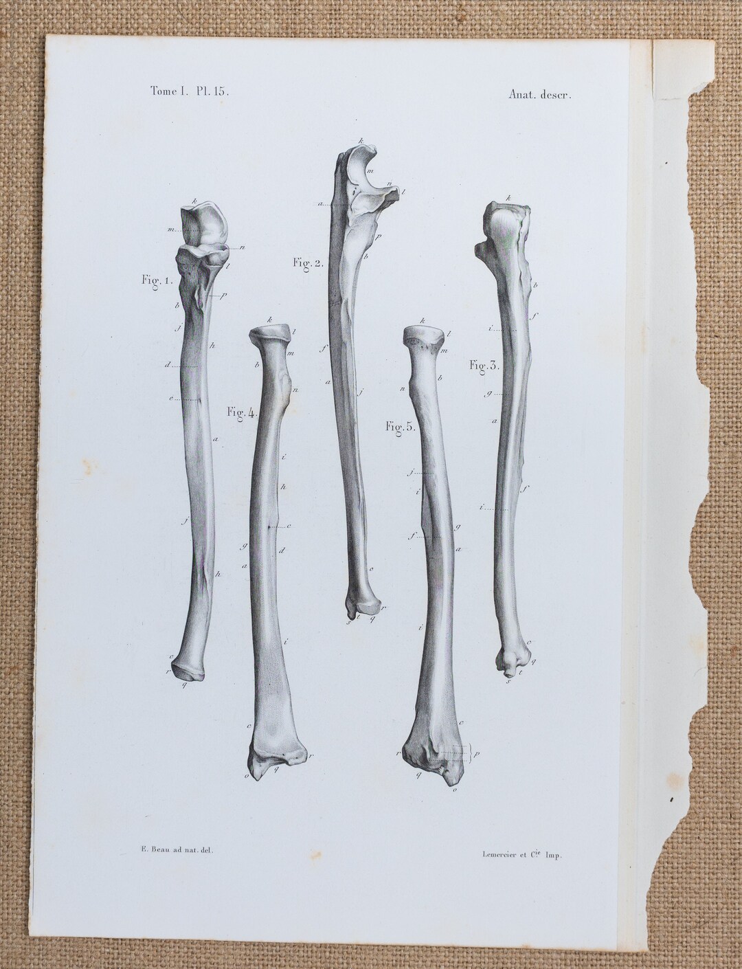 Forearm Bones- RARE ORIGINAL PRINT From Atlas D'anatomie Descriptive Du ...
