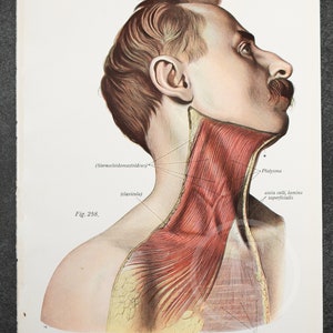 Neck and Chest Part of the Platysma Muscle / Neck Glands, Muscles ...