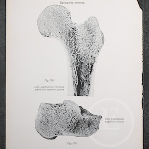 Metatarsal Bones: Heel. Cuboid, Navicular / Spongy Bone / Human Anatomu ...