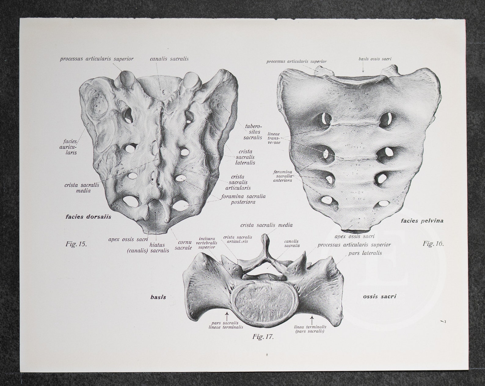 Bones: Sacrum / Coccyx - Human Anatomy - Descriptive Anatomy Book From ...