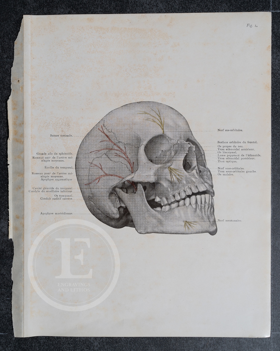 Skull With the Three Main Sensory Nerves of the Face - Human Anatomy ...