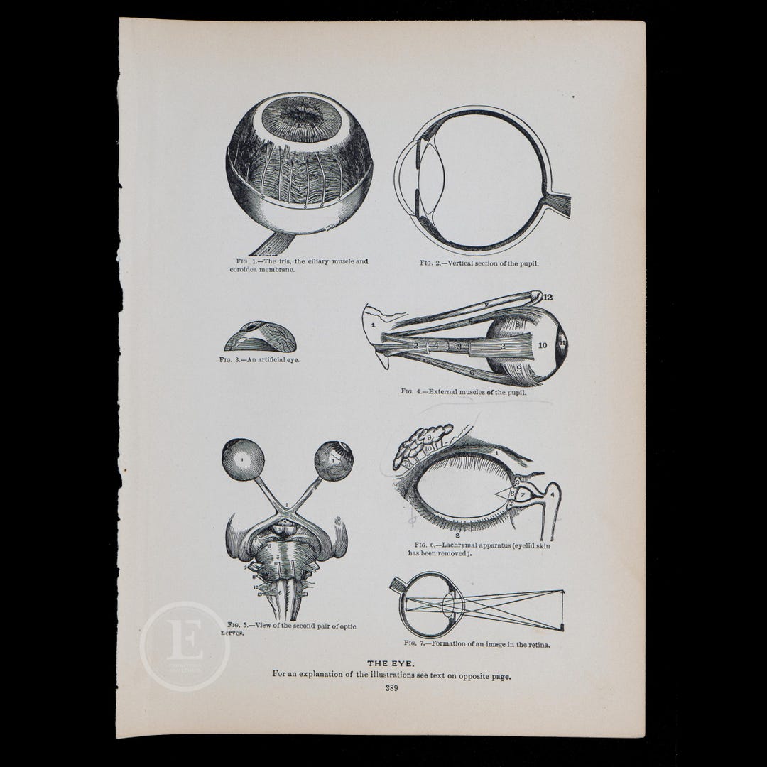 1901 THE HUMAN EYE - Interactive Human Anatomy-original Lithograph From ...