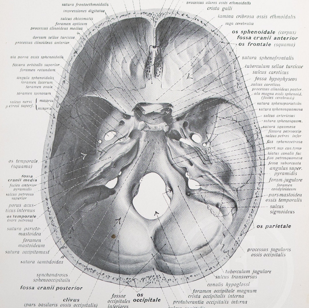 Inner Base of the Skull /skull Damage From Inside /- Human Anatomy ...