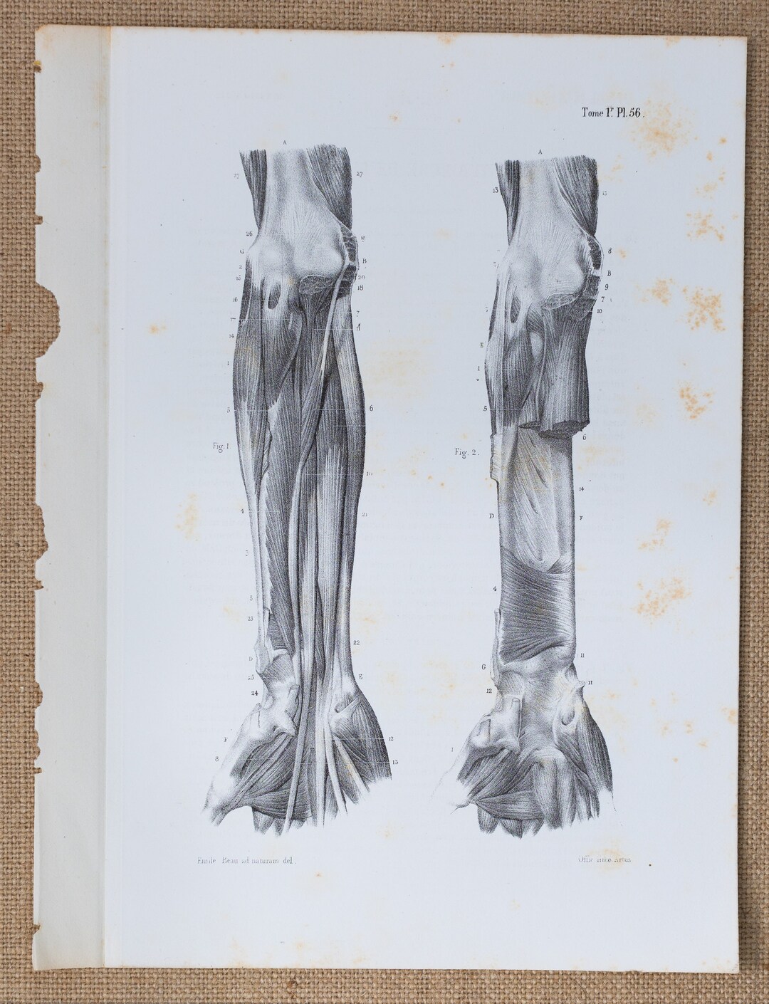 Forearm: Second Radialis Muscle RARE ORIGINAL PRINT From Atlas D ...