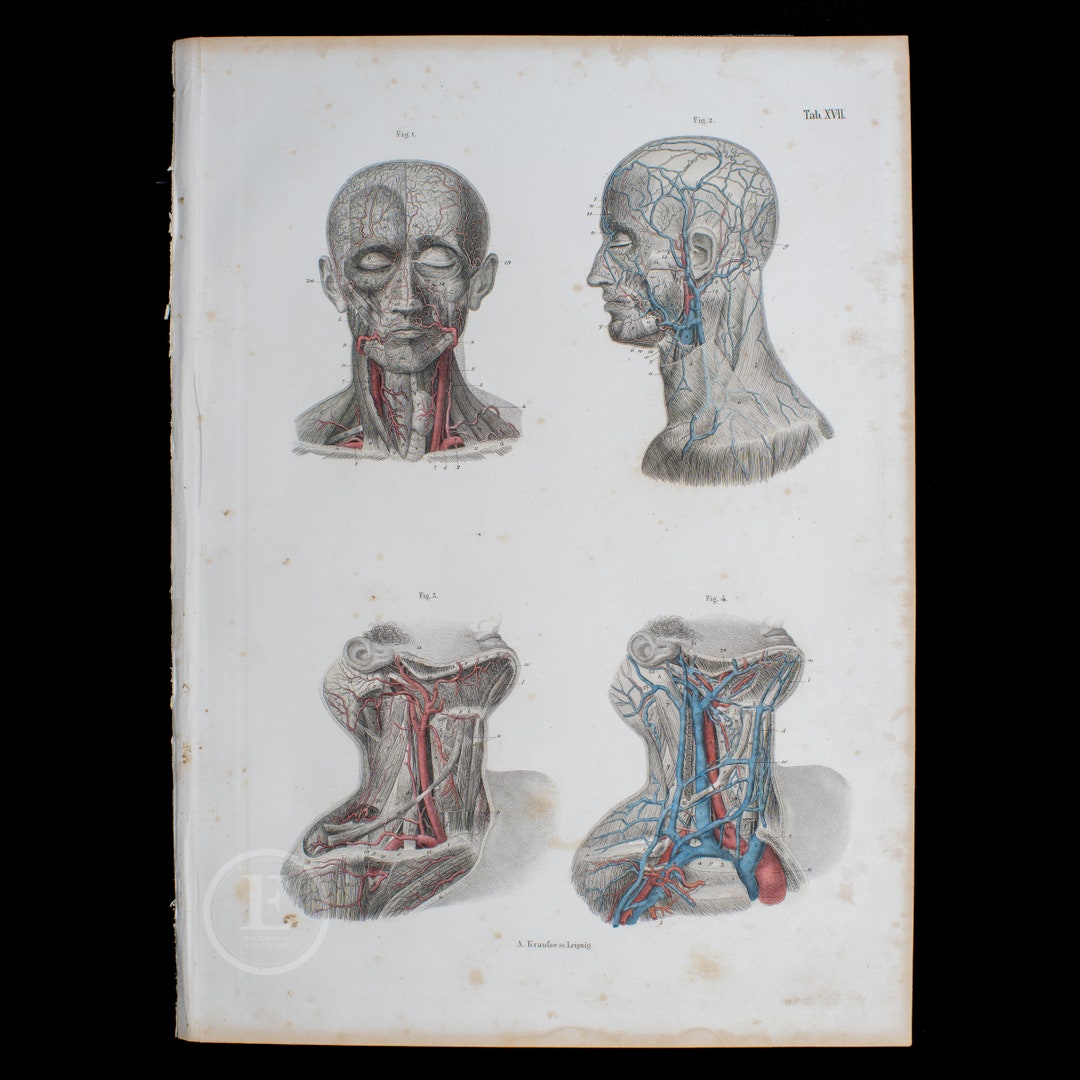 1860 Blood Vessels of the Neck and Head- Original Steel Engravings From ...
