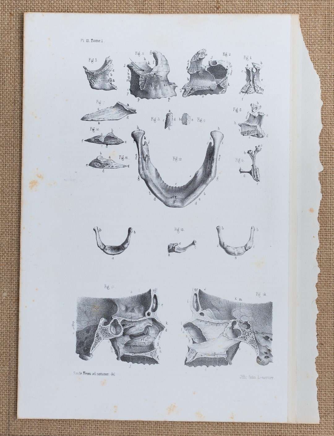 Facial Bones - RARE ORIGINAL PRINT From Atlas D'anatomie Descriptive Du ...