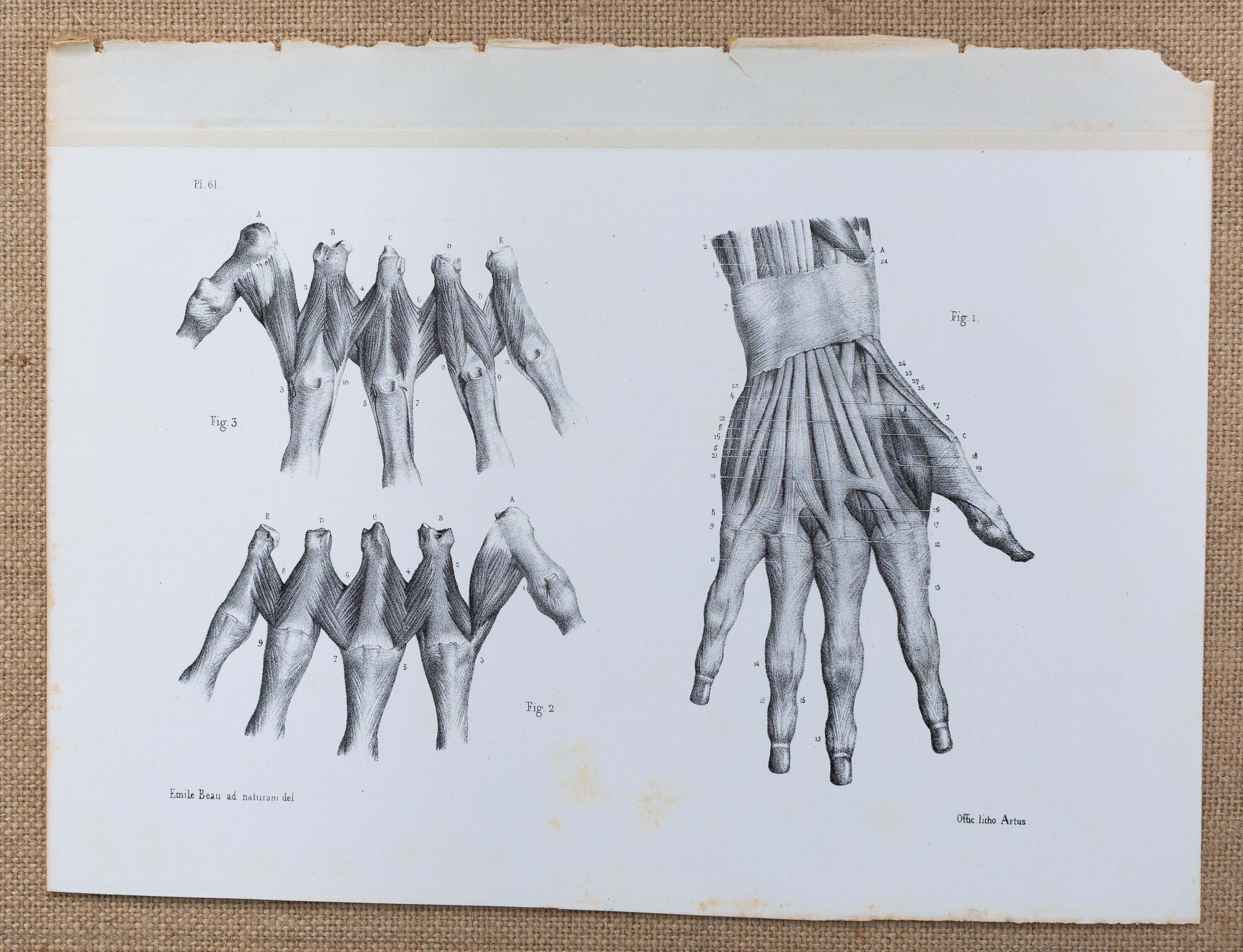 Hand Anatomy - RARE ORIGINAL PRINT From Atlas D'anatomie Descriptive Du ...