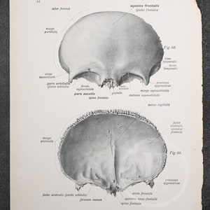 Parietal Bone / Frontal Bone / Human Anatomy - Descriptive Anatomy Book ...