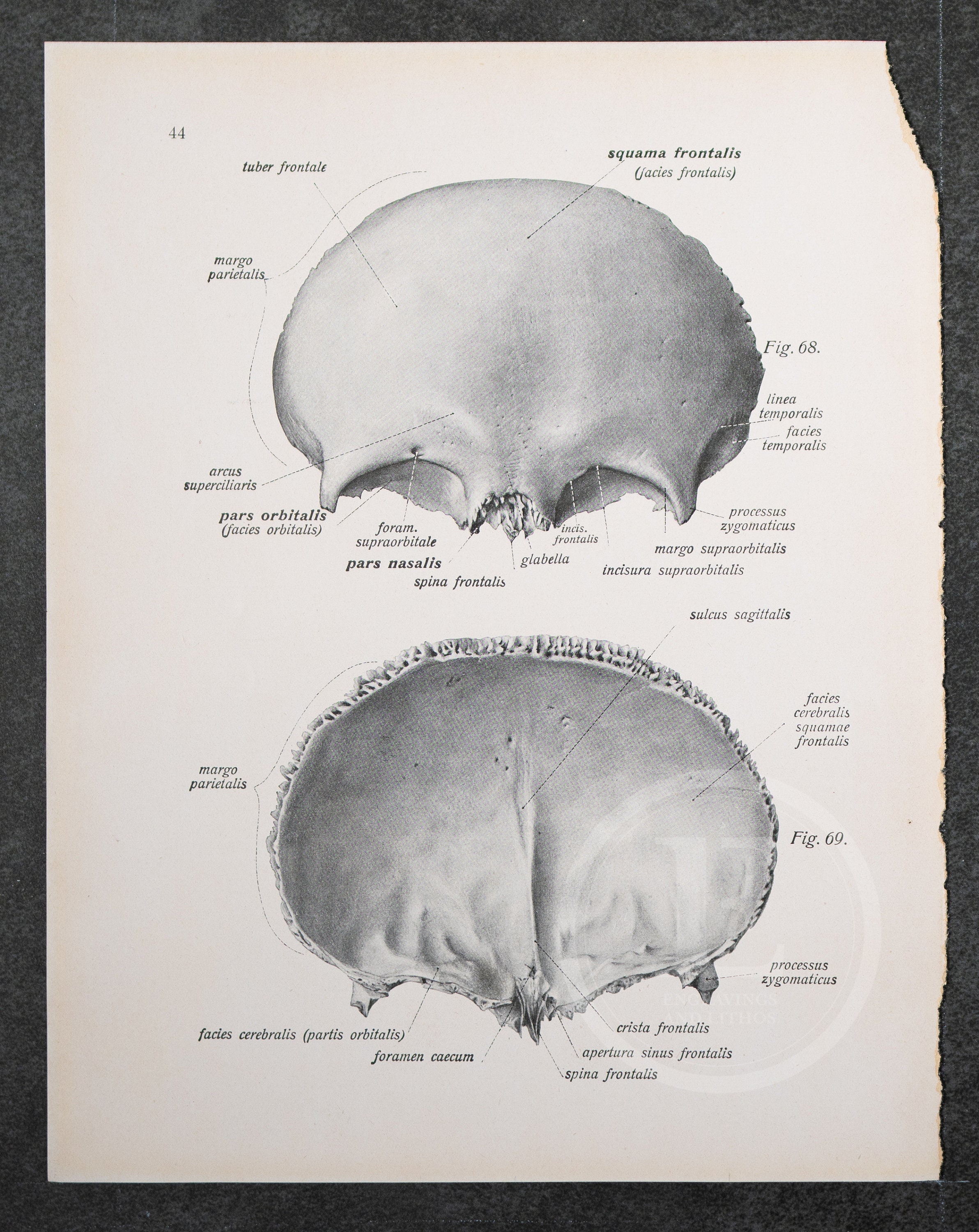 Frontal Bone