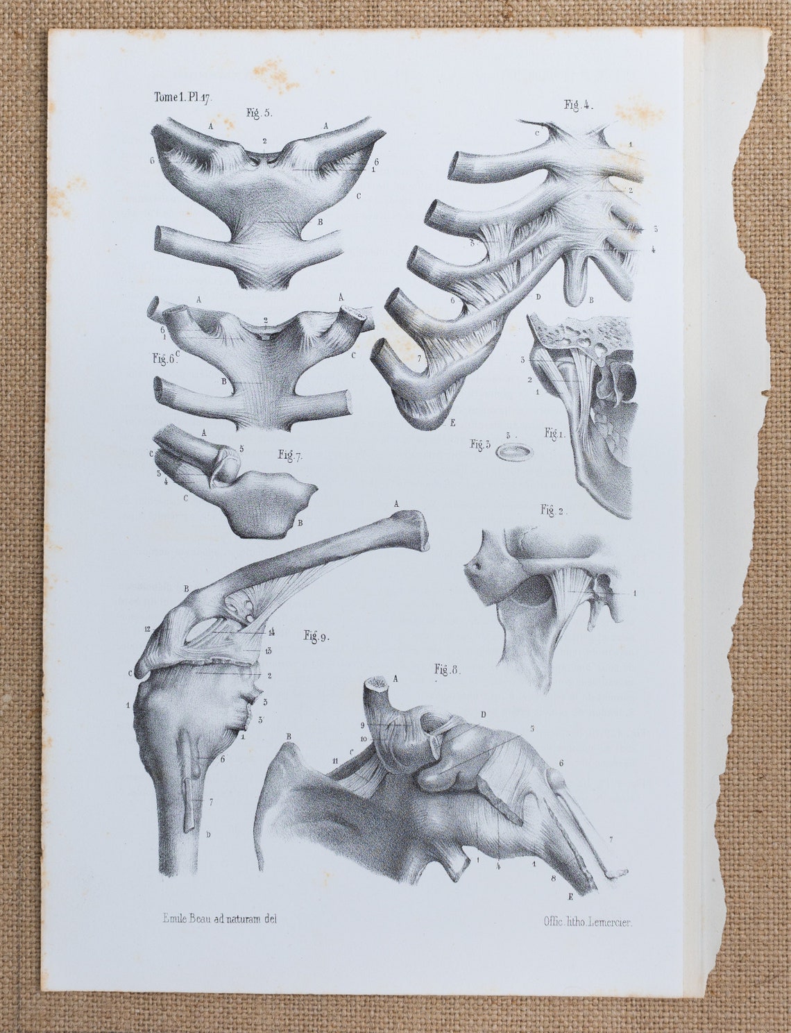 Maxillary and Thoracic Joints RARE ORIGINAL PRINT From Atlas - Etsy