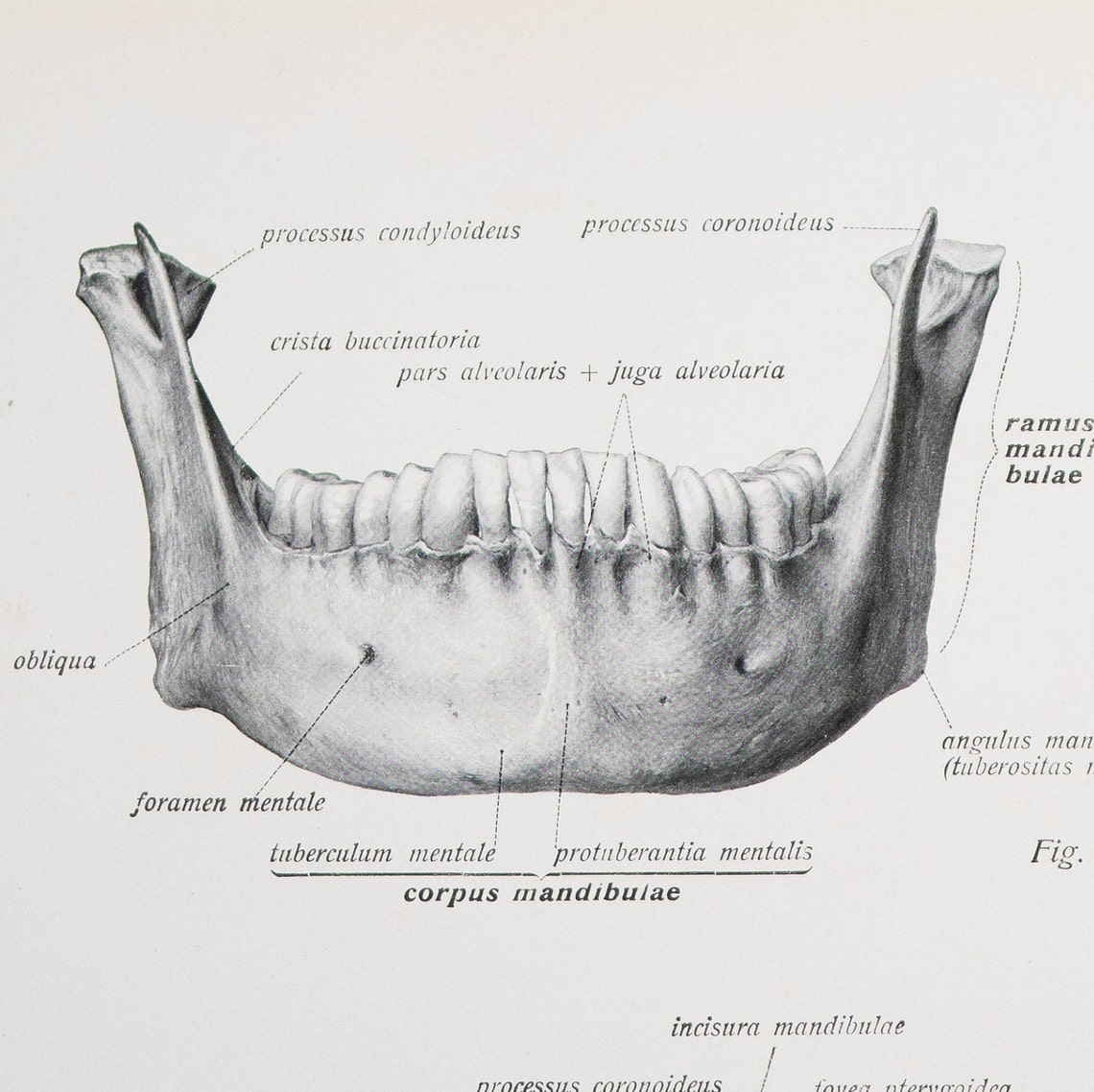 Lower Jaw/ Hyoid Bone / Human Anatomy - Descriptive Anatomy Book From ...