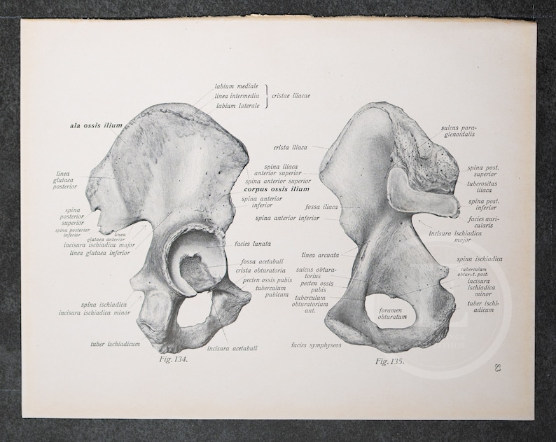 1926 Vintage Hip Bones : Illium, Ischium, Pubis - Vintage Human Anatomy ...