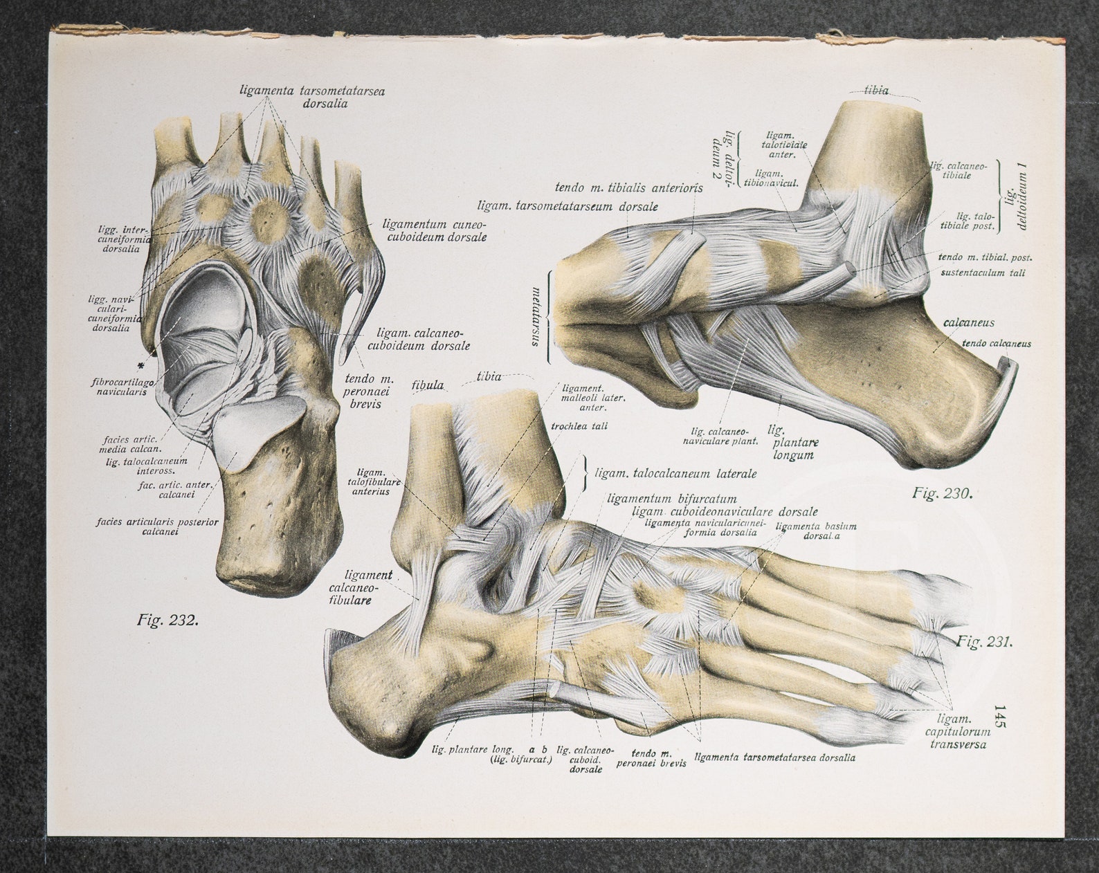 Joints and Ligaments: Foot Midfoot and Toe / Human Anatomy - Etsy