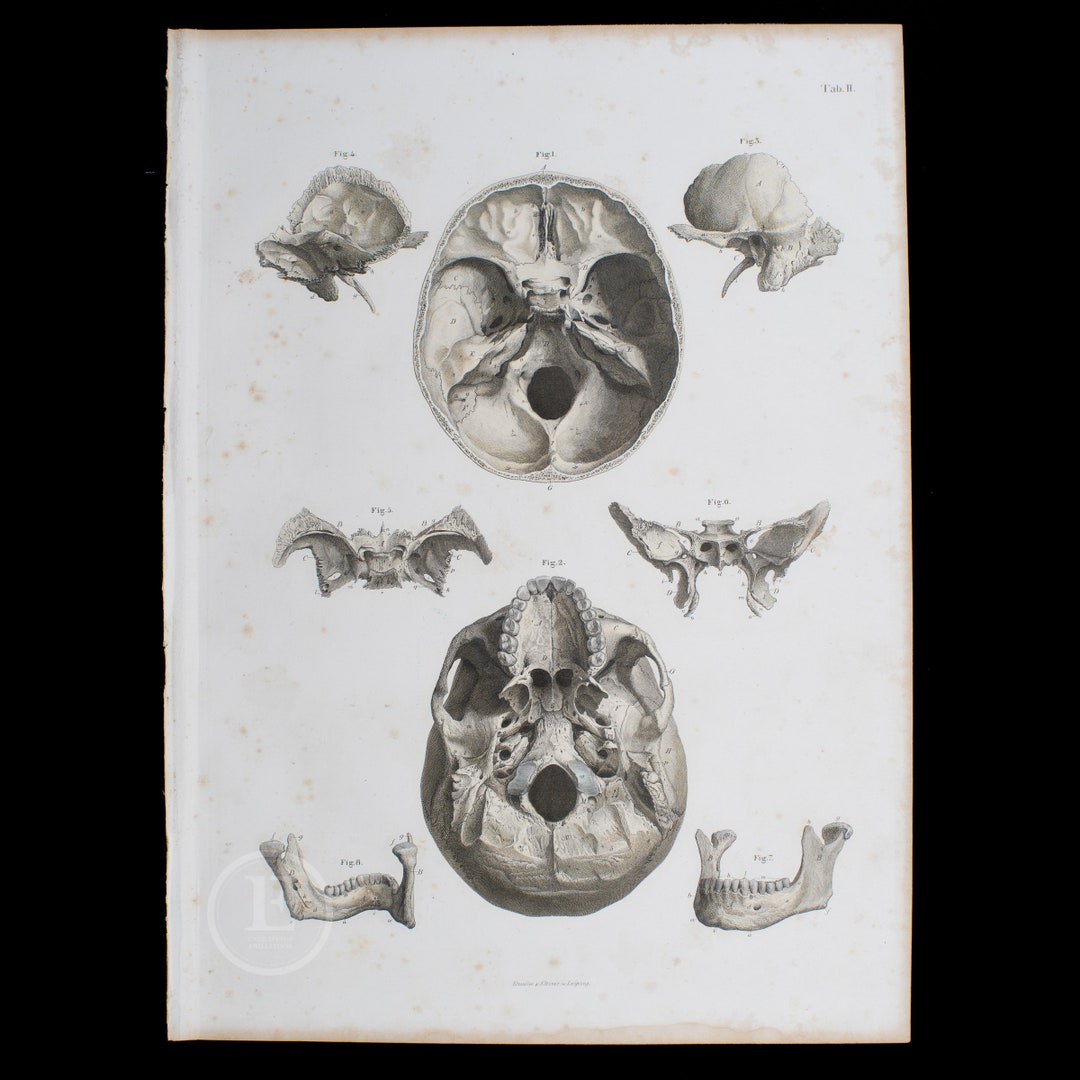 1860 Bones of the Skull – Hand-colored Steel Engraving From an Atlas of ...