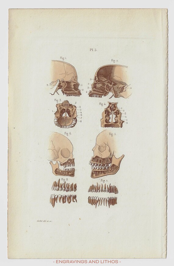 Vertical Section of Skull and Nasal Septum RARE ORIGINAL - Etsy