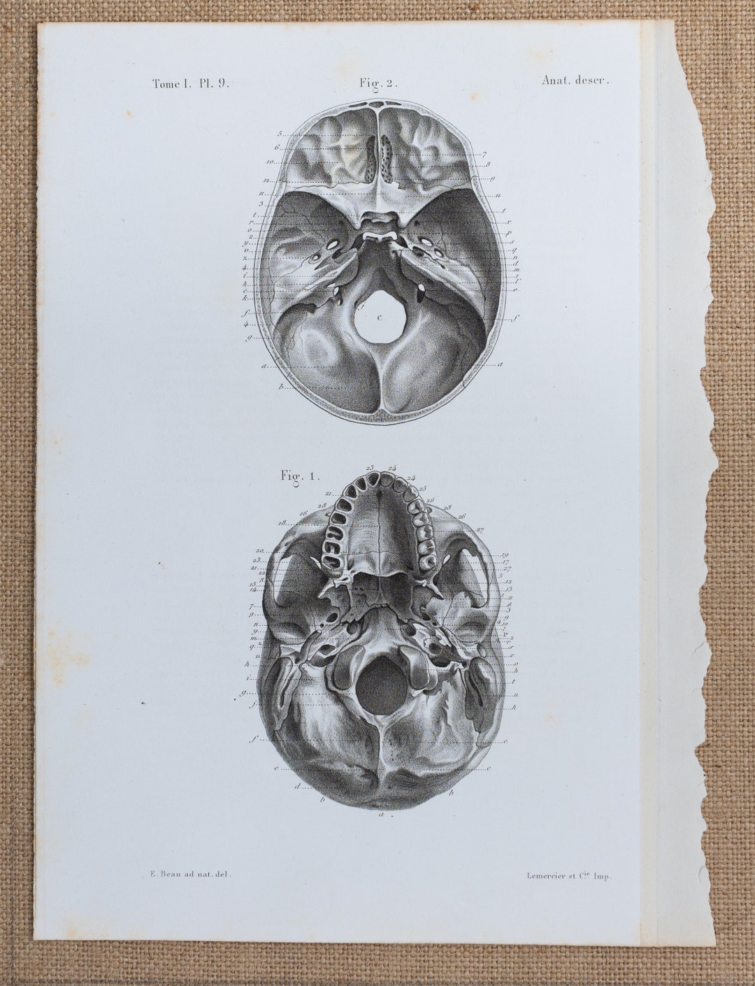Human Skull - RARE ORIGINAL PRINT From Atlas D'anatomie Descriptive Du ...