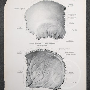 Parietal Bone / Frontal Bone / Human Anatomy - Descriptive Anatomy Book ...