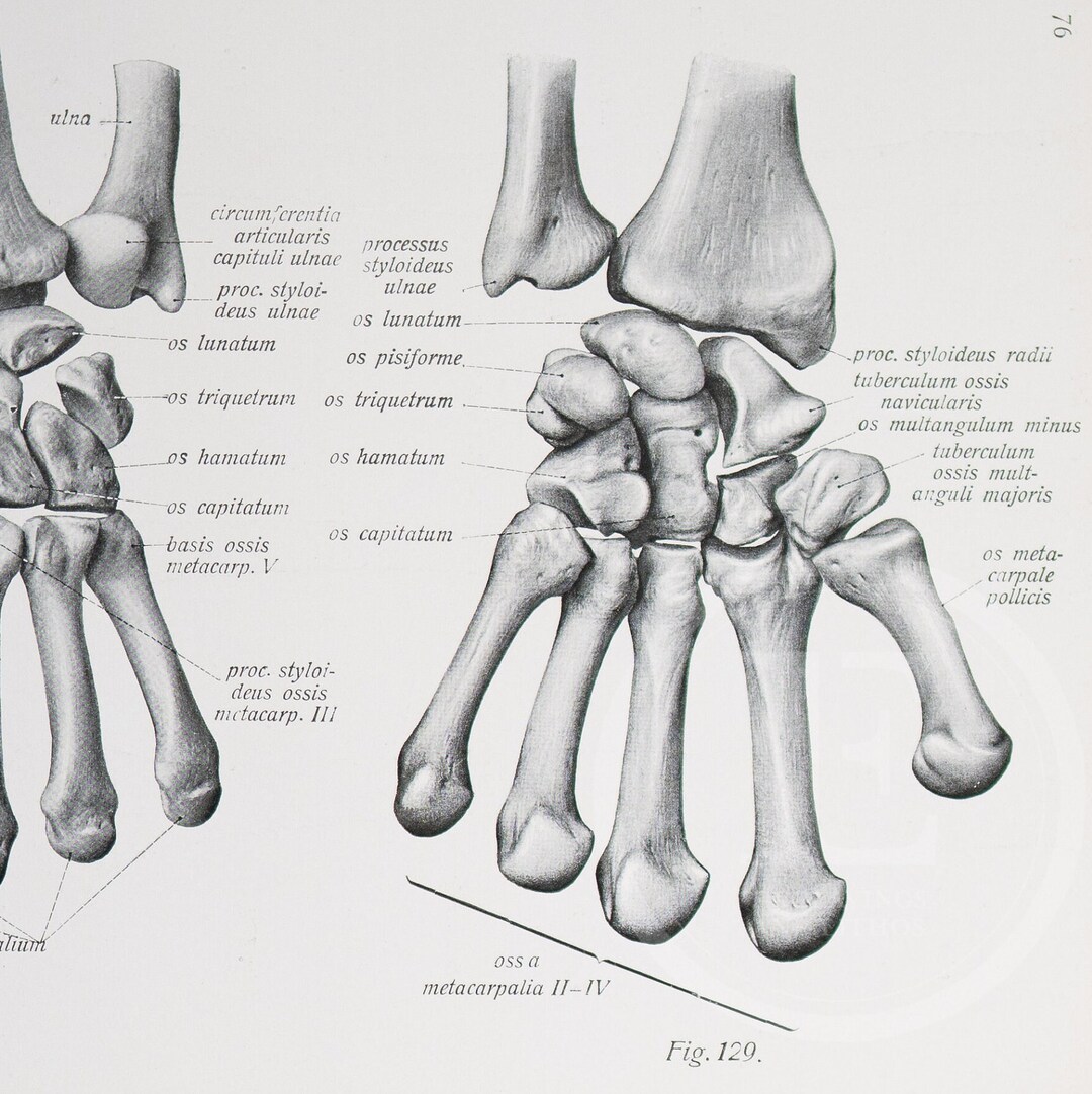 Bones of the Hand: Carpal / Lower Arm Bone / Human Anatomy ...