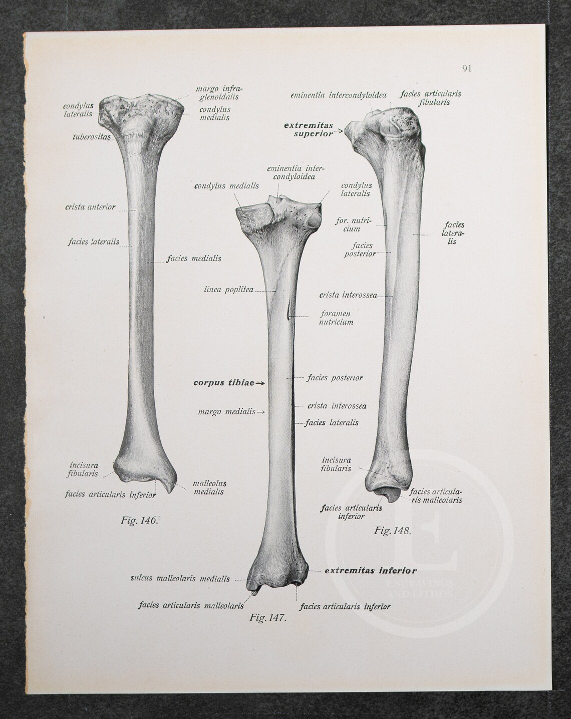 Leg Bones: Tibia / Fibula /human Anatomy - Descriptive Anatomy Book ...