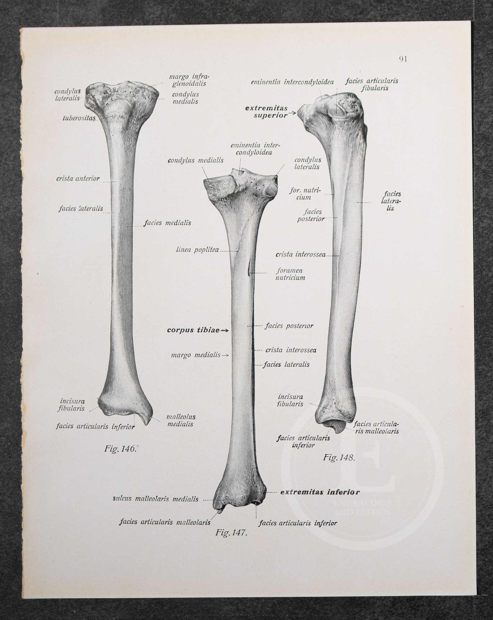 Leg Bones: Tibia / Fibula /human Anatomy - Descriptive Anatomy Book ...