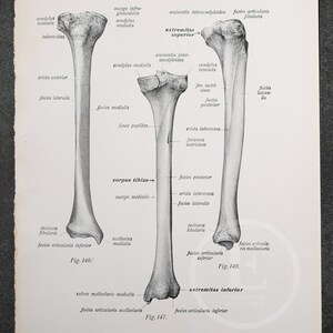 Leg Bones: Tibia / Fibula /human Anatomy - Descriptive Anatomy Book ...