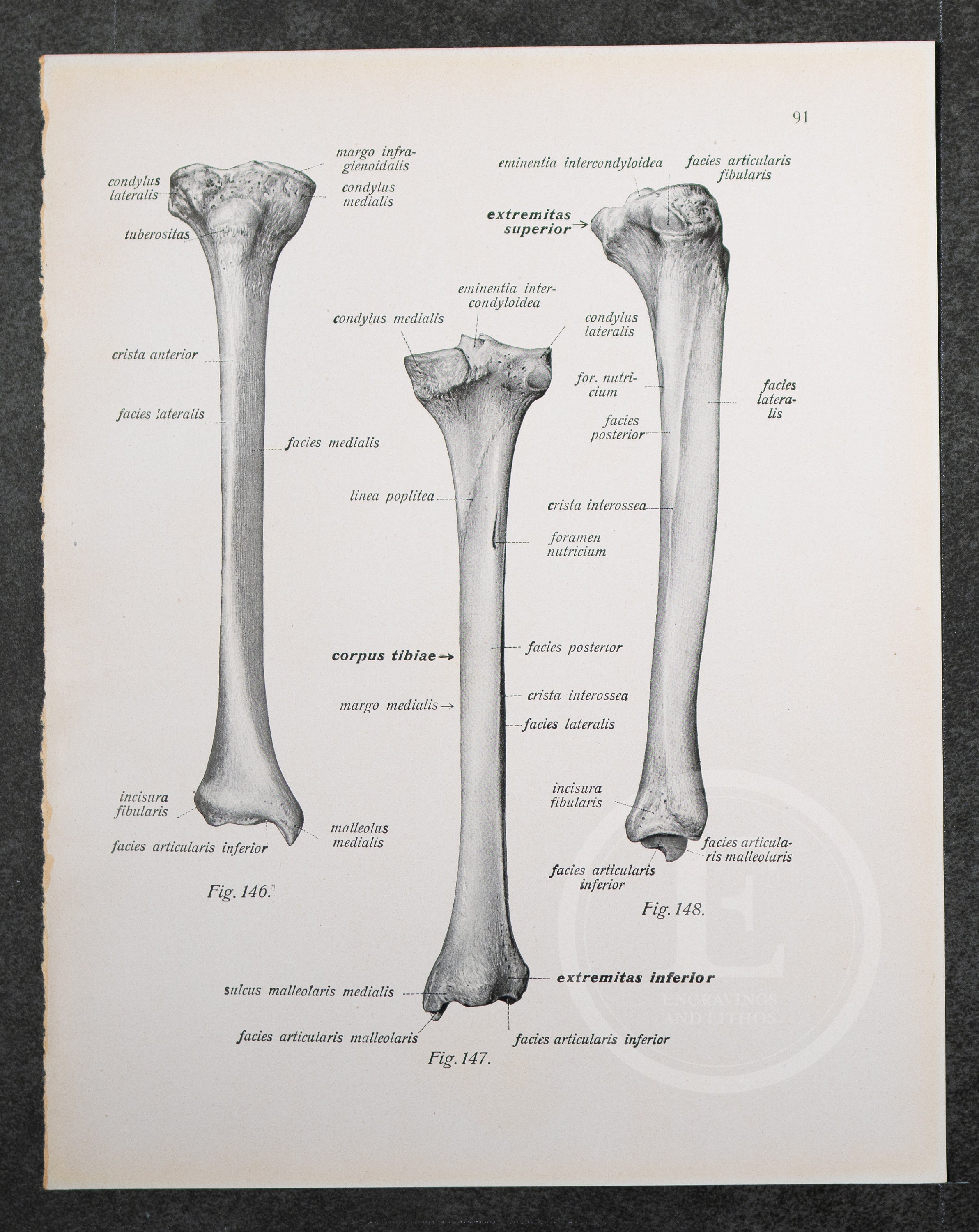 Tibia Bone Posterior