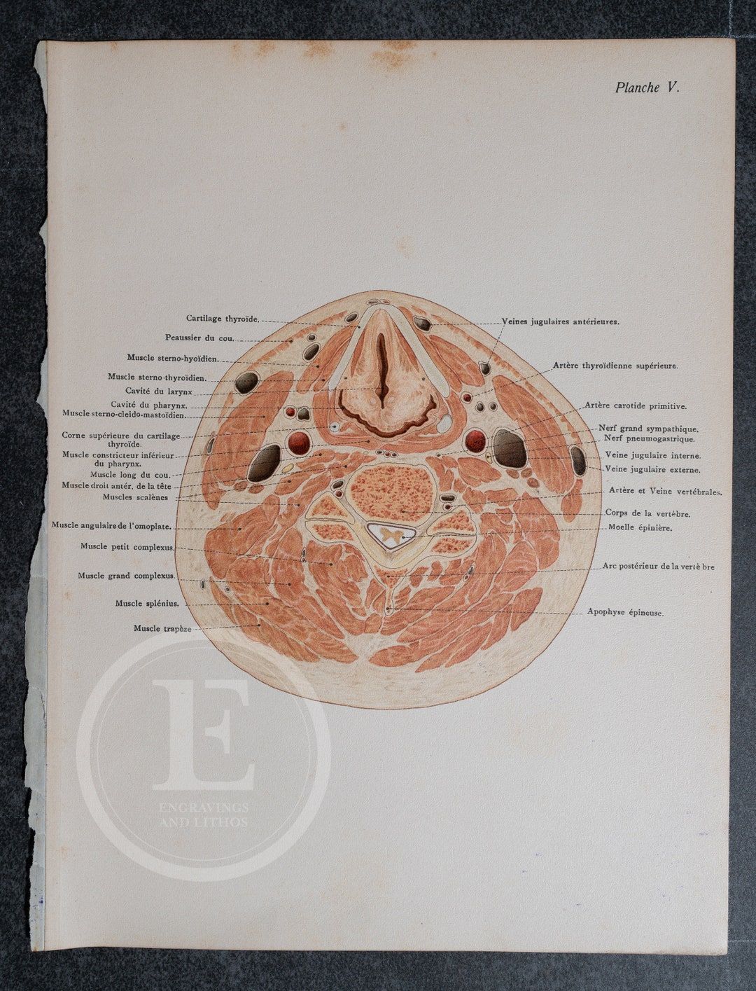 Transverse Section of the Neck on a Frozen Subject - Human Anatomy ...