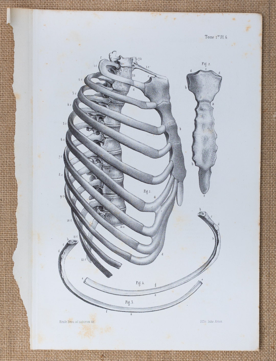 Thorax Ribs Cage Anatomy - RARE ORIGINAL PRINT From Atlas D'anatomie ...