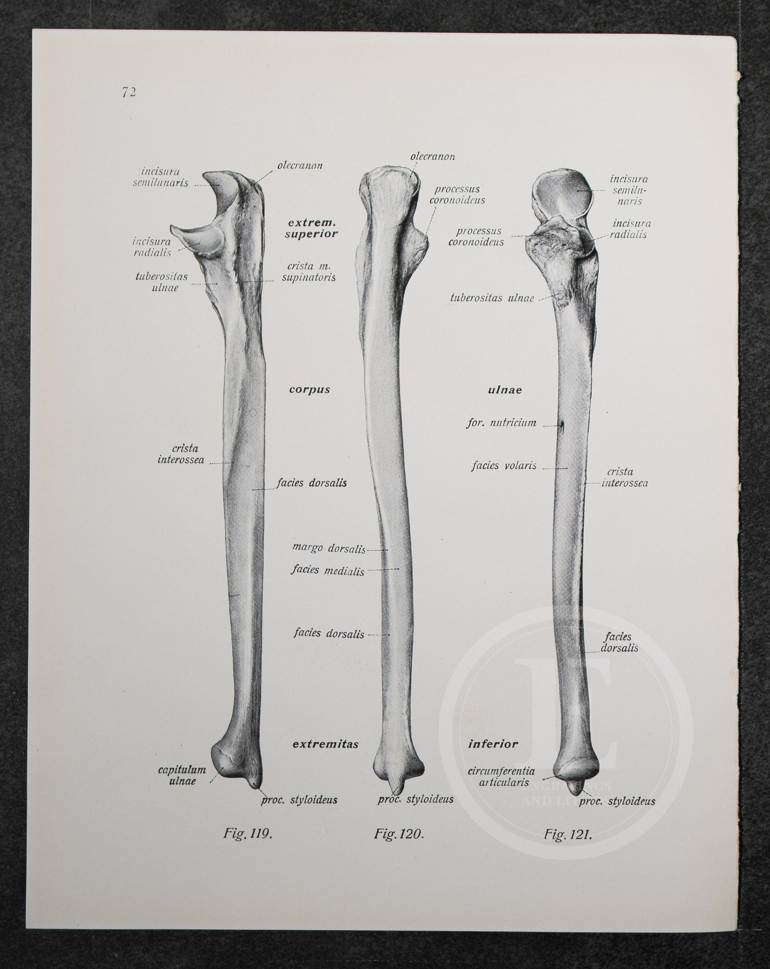 Upper Limb Bones: Humerus, Forearm / Human Anatomy - Descriptive ...