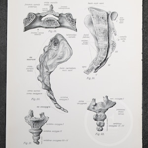 Bones: Sacrum / Coccyx - Human Anatomy - Descriptive Anatomy Book From ...
