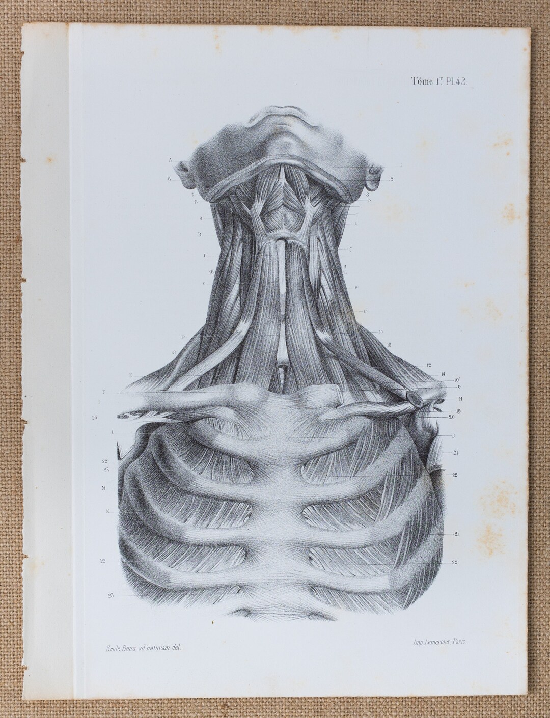 Anterior Neck Muscles - RARE ORIGINAL PRINT From Atlas D'anatomie ...