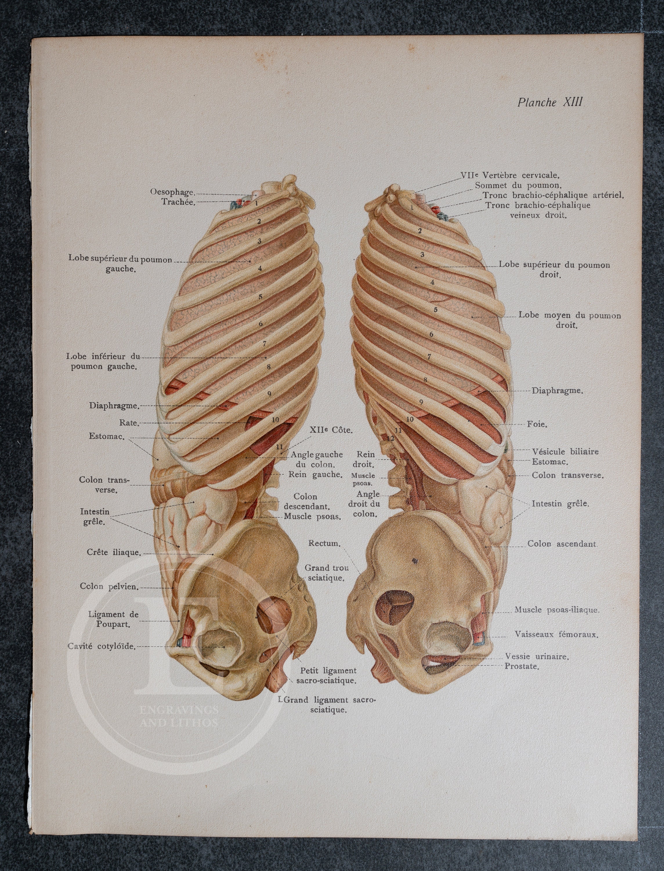 Thoracic and Abdominal Organs Left and Right Lateral View - Etsy