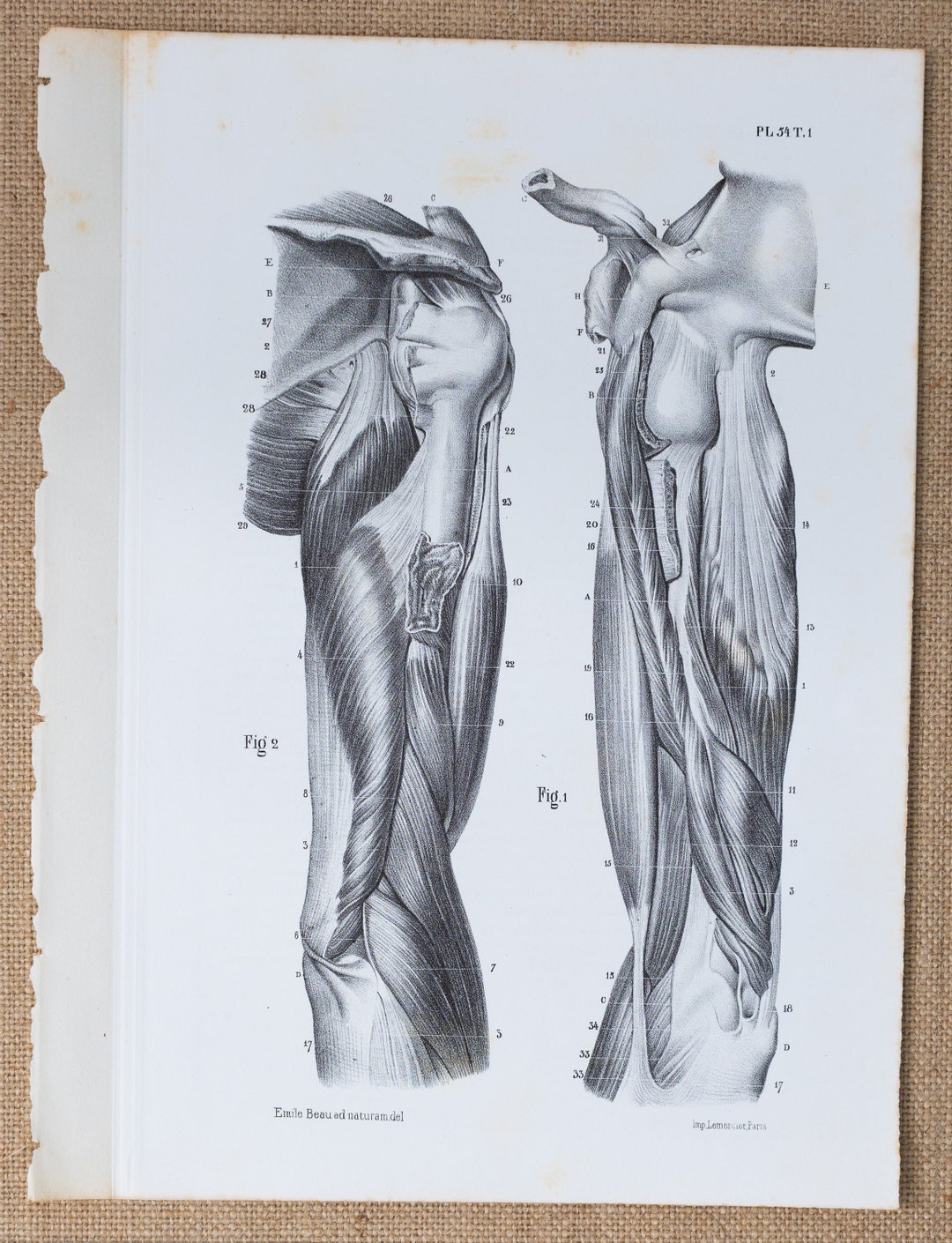 Internal and External Arm Muscles - RARE ORIGINAL PRINT From Atlas D ...