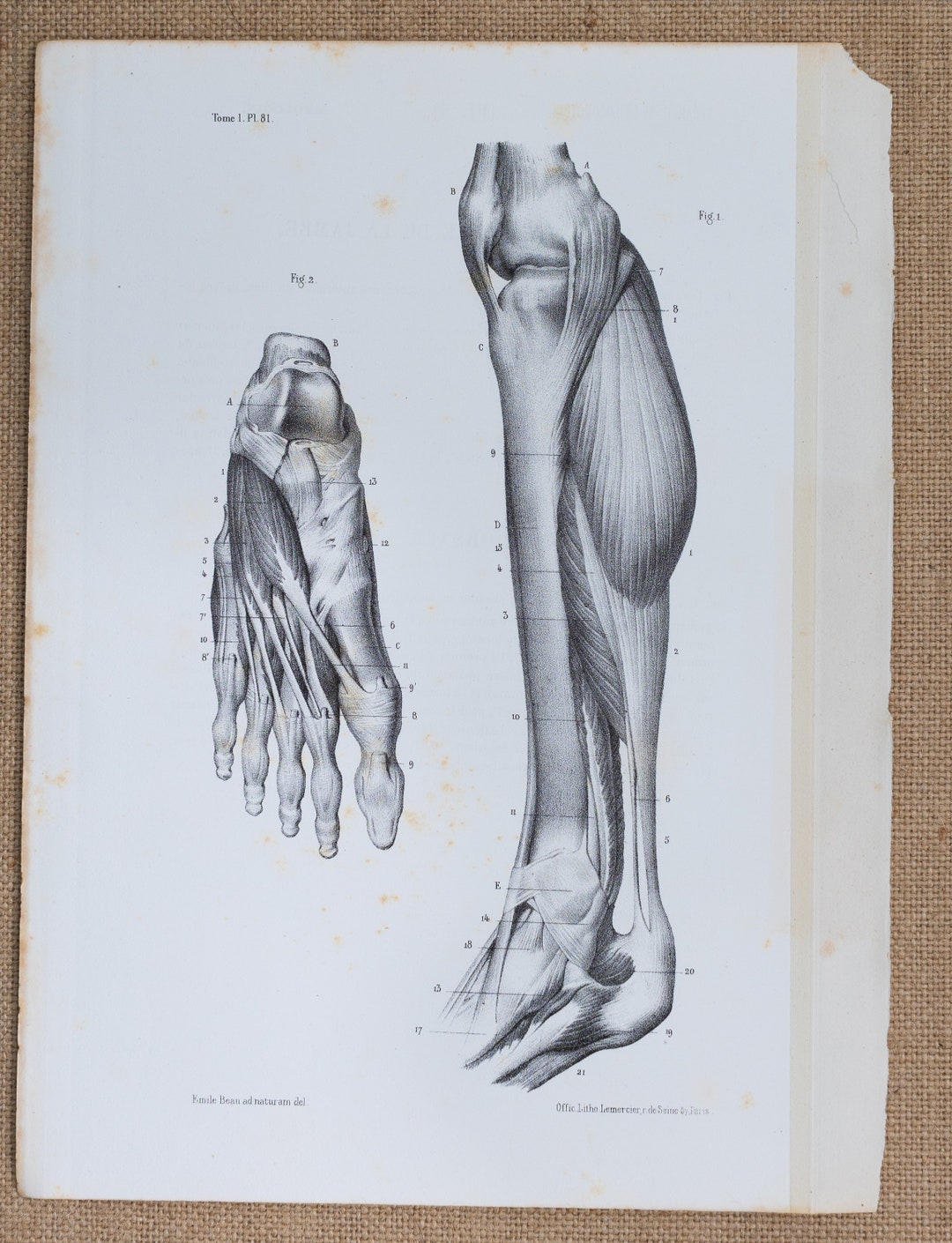 Internal Leg and Dorsal Foot Muscles - RARE ORIGINAL PRINT From Atlas D ...