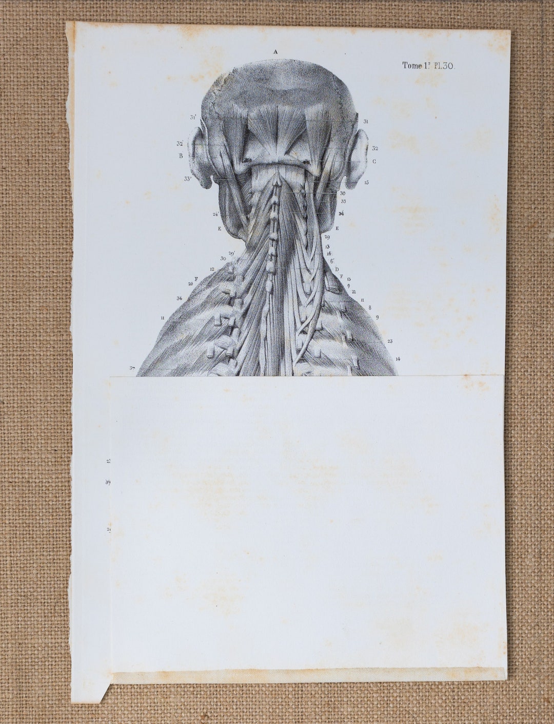 Posterior Trunk Muscle - Fifth Layer - RARE ORIGINAL PRINT From Atlas D ...