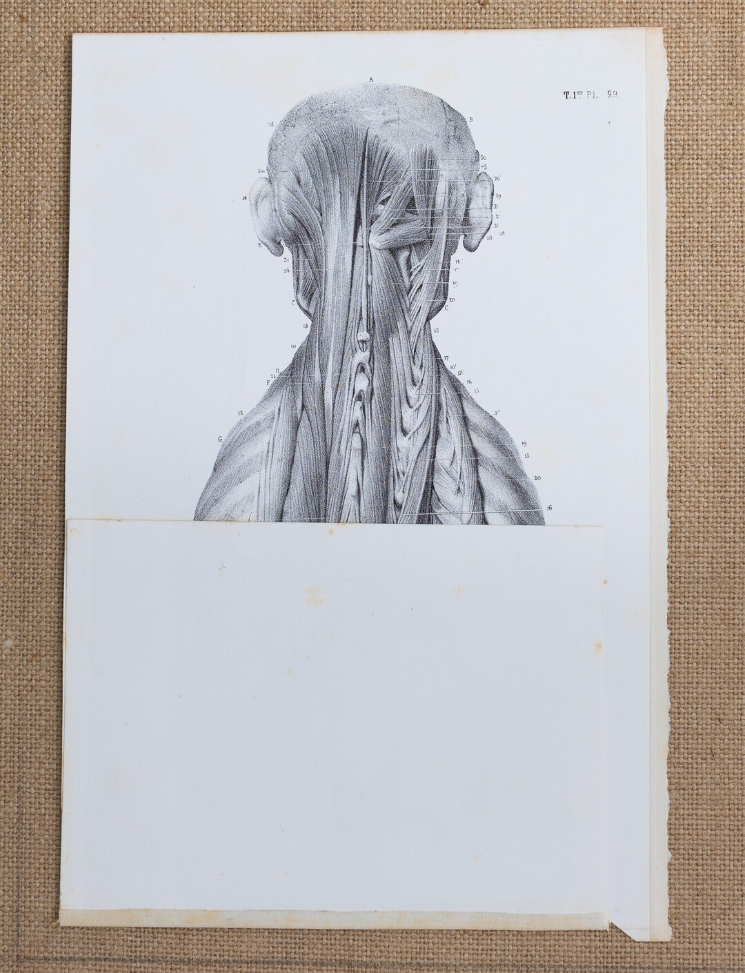 Posterior Trunk Muscle - Fourth Layer - RARE ORIGINAL PRINT From Atlas ...