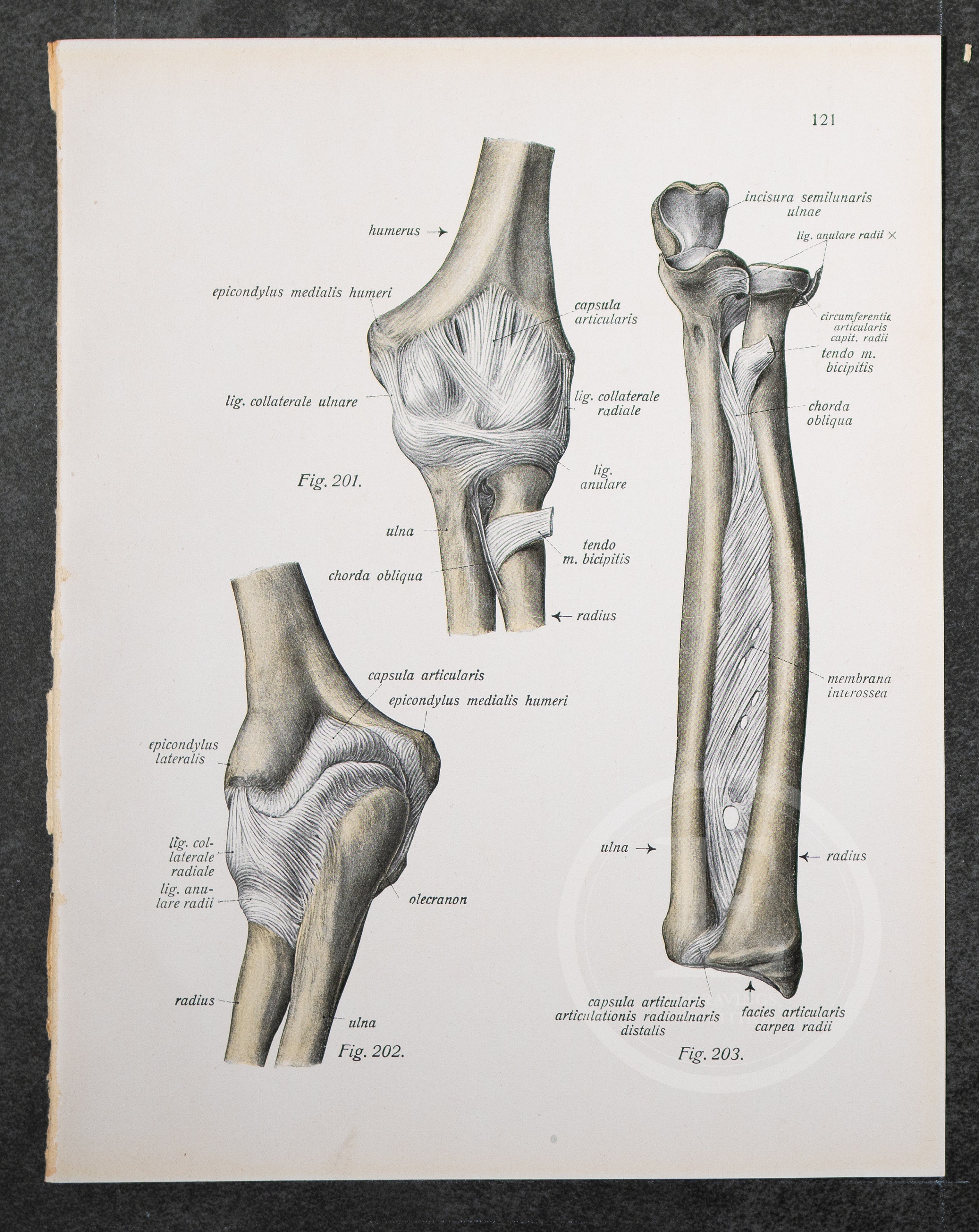 Elbow Joint, Forearm Bones: Radius and Ulna / Distal Radioulnar/human ...